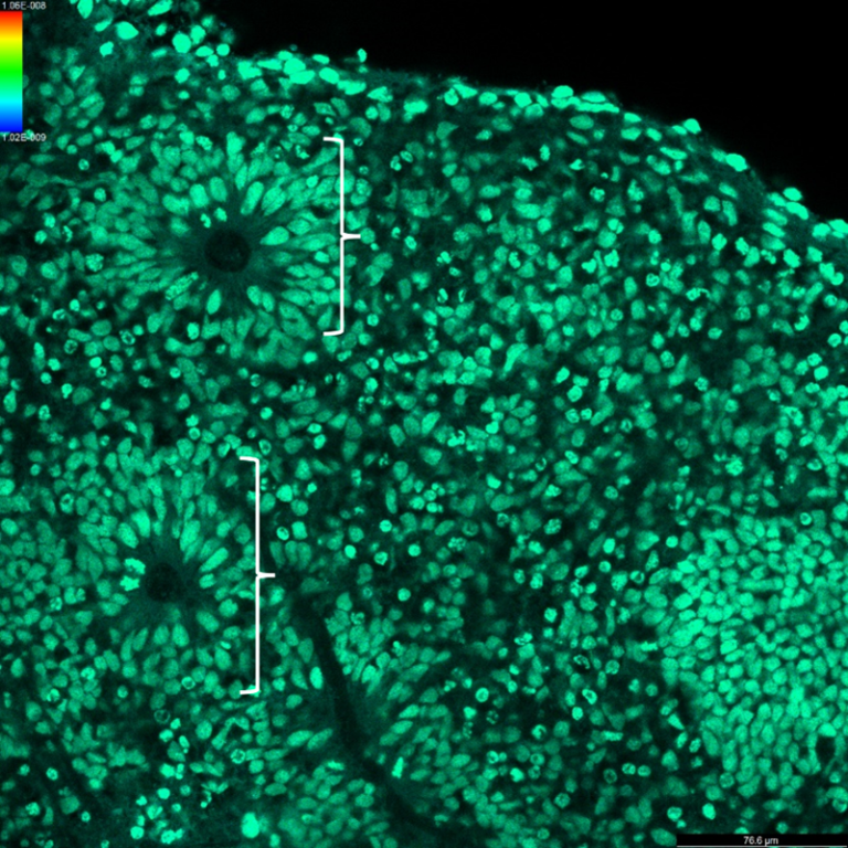 A trip to Ireland for human organoid engineering – a Travelling ...
