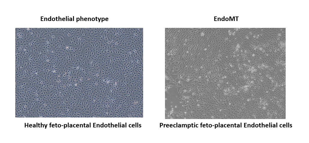 A Travelling Fellowship to probe placental cell crosstalk - The Company ...